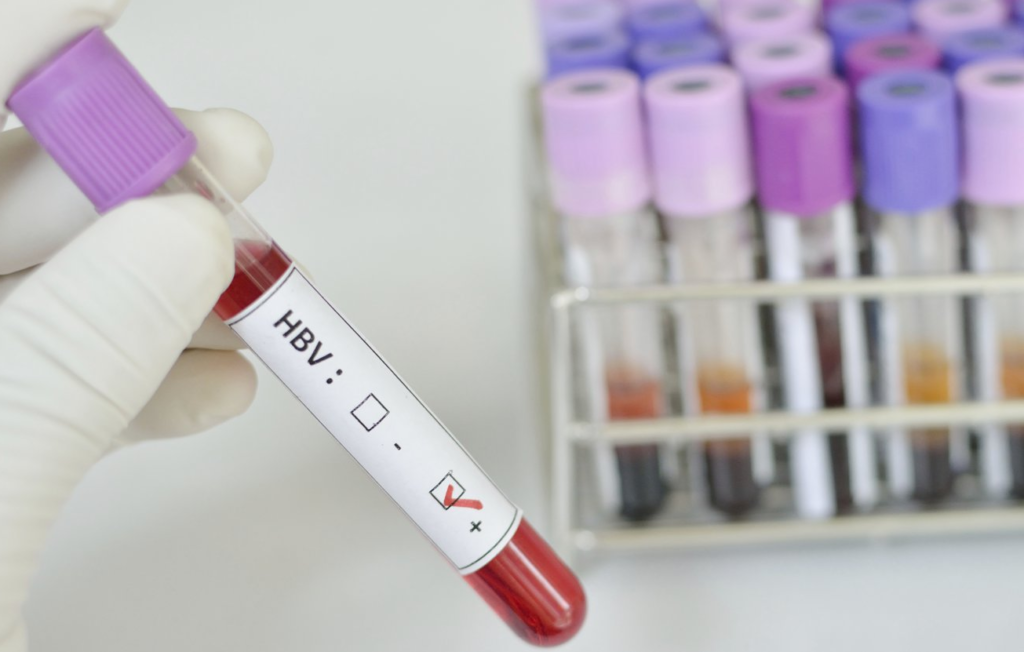 What is a Titer Test for Dogs?